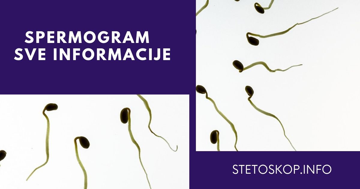Spermogram - kako se radi i šta otkriva