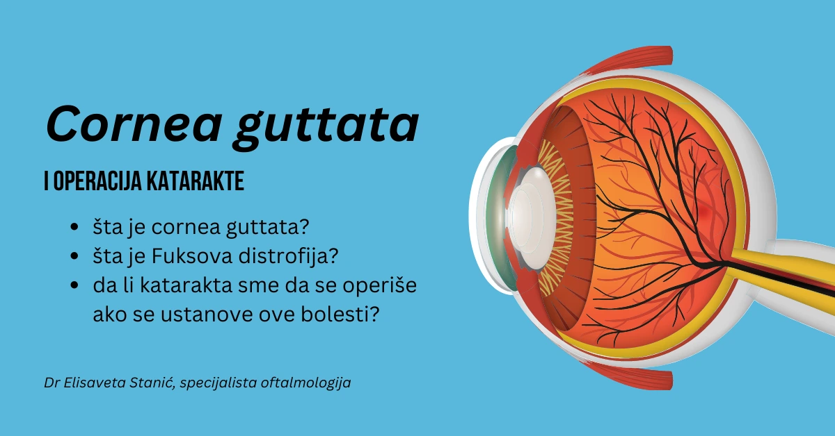 Cornea guttata i operacija katarakte